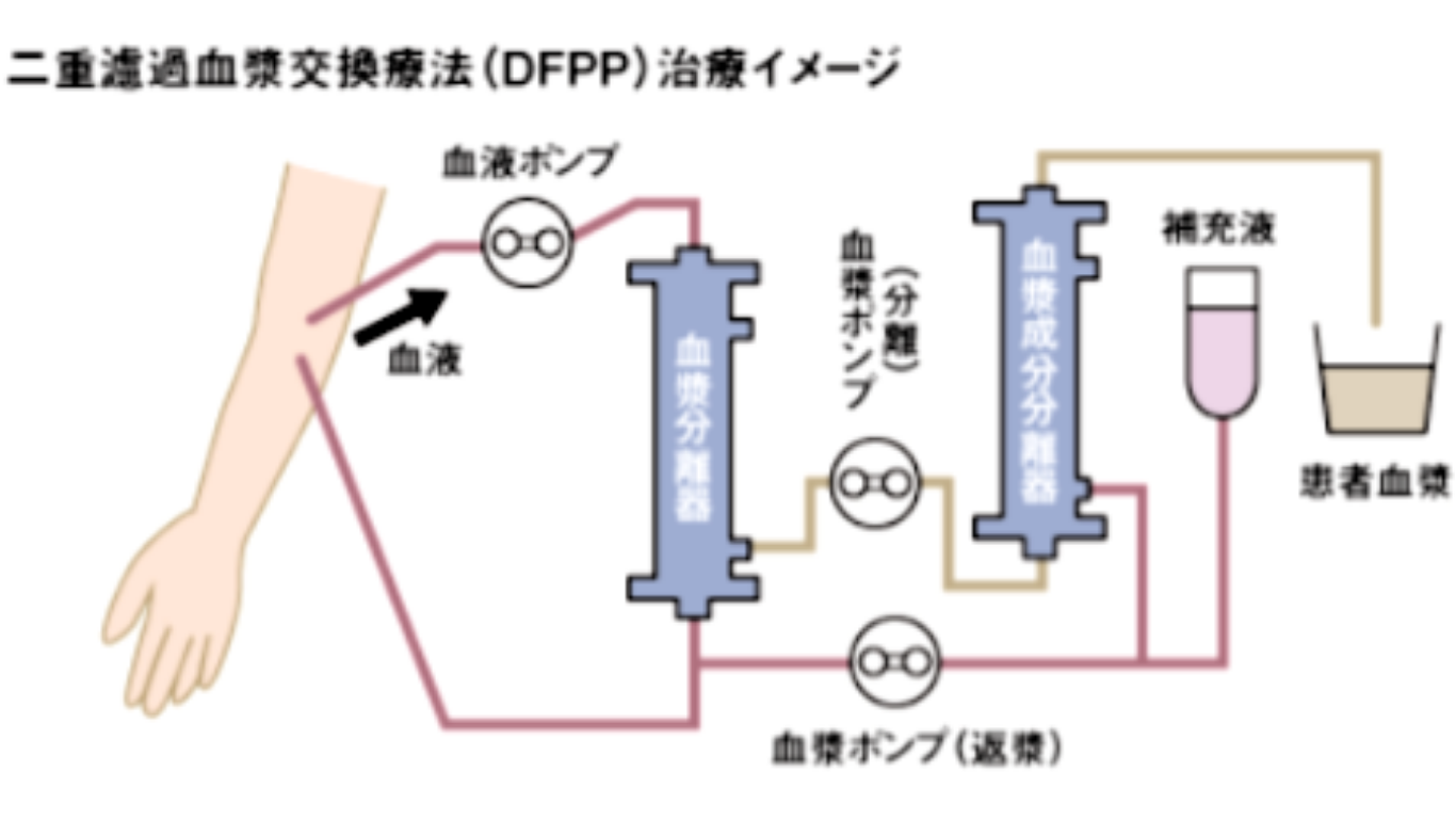 DFサーモ治療（DFPP）｜岸田クリニック｜本町、豊中市、人工透析、休日診療、人工透析内科、内科、循環器内科、糖尿病内科、内分泌・代謝内科｜完全予約制